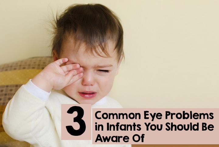 Baby Sticky Eye | Infective Conjunctivitis: Causes, Symptoms, and ...