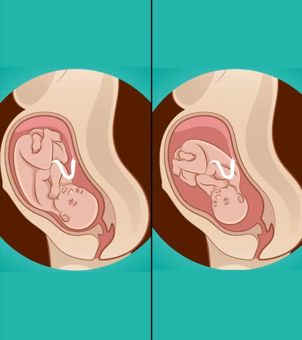 Cephalic baby position store