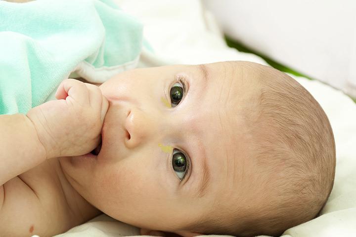 7 Causes Of Sticky Eyes In Newborn Babies And Treatment