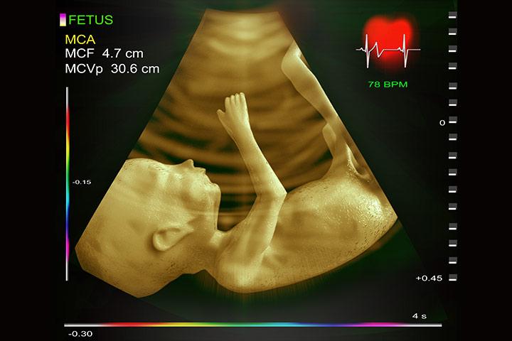 What Is Fetal Echocardiogram And Why Is It Done?