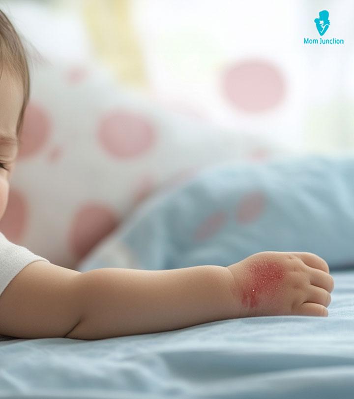 Stomach Ulcer During Pregnancy: Causes, Symptoms & Treatment