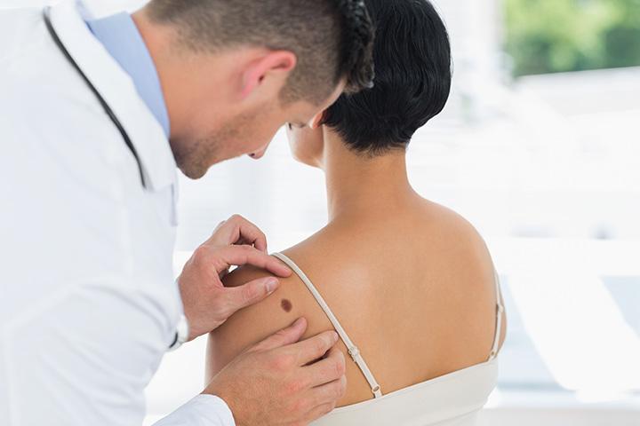 Change In Moles During Pregnancy: What Is Normal?