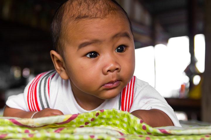 Sandifer Syndrome In Babies: Causes, Symptoms And Treatment