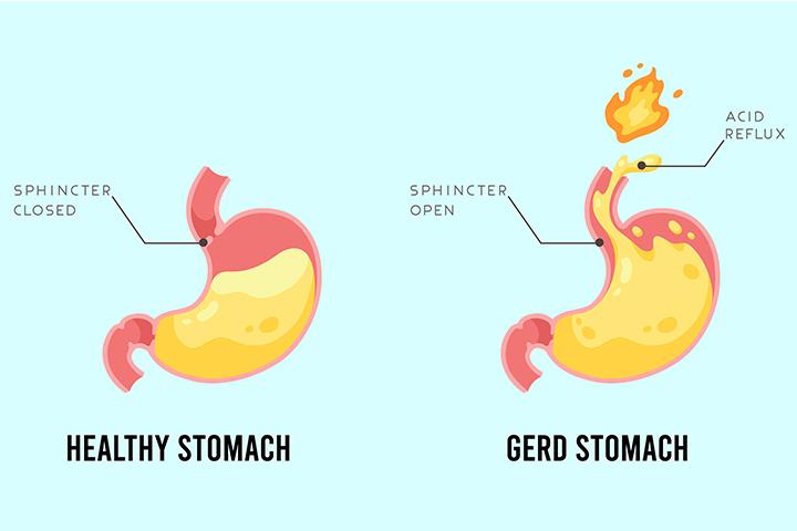 Stomach Acid Color