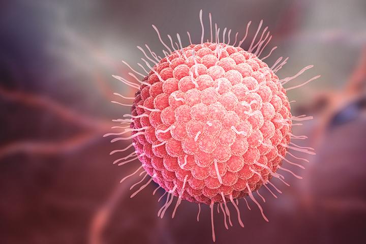 Shingles In Babies: Symptoms, Causes, Diagnosis & Treatment