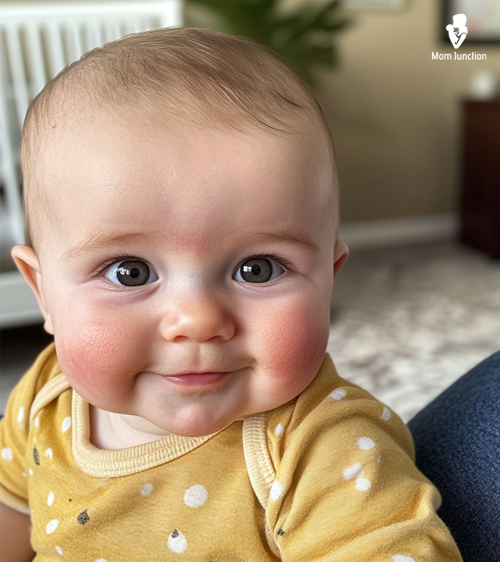 Petechiae On Baby: Causes, Symptoms, Diagnosis And Treatment