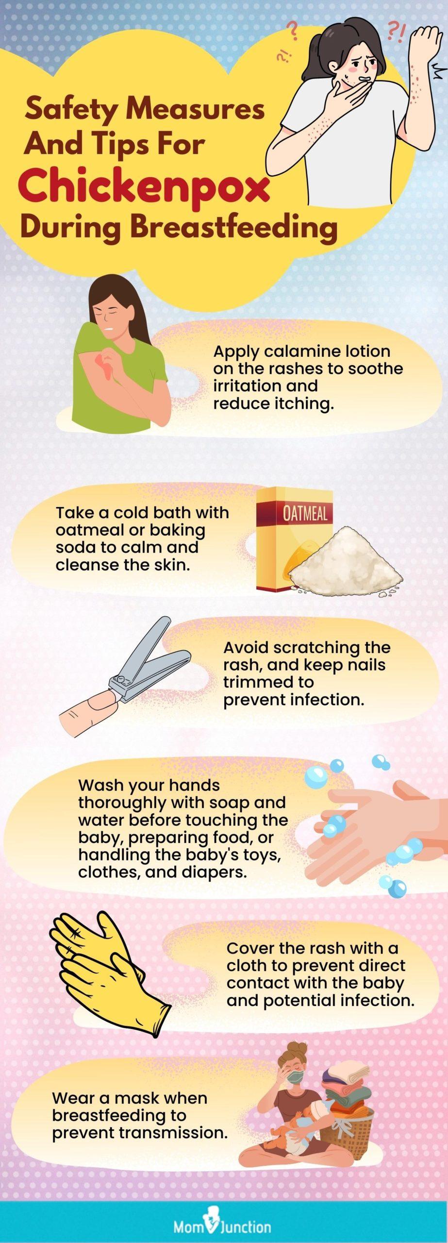 Chicken Pox Treatment And Prevention