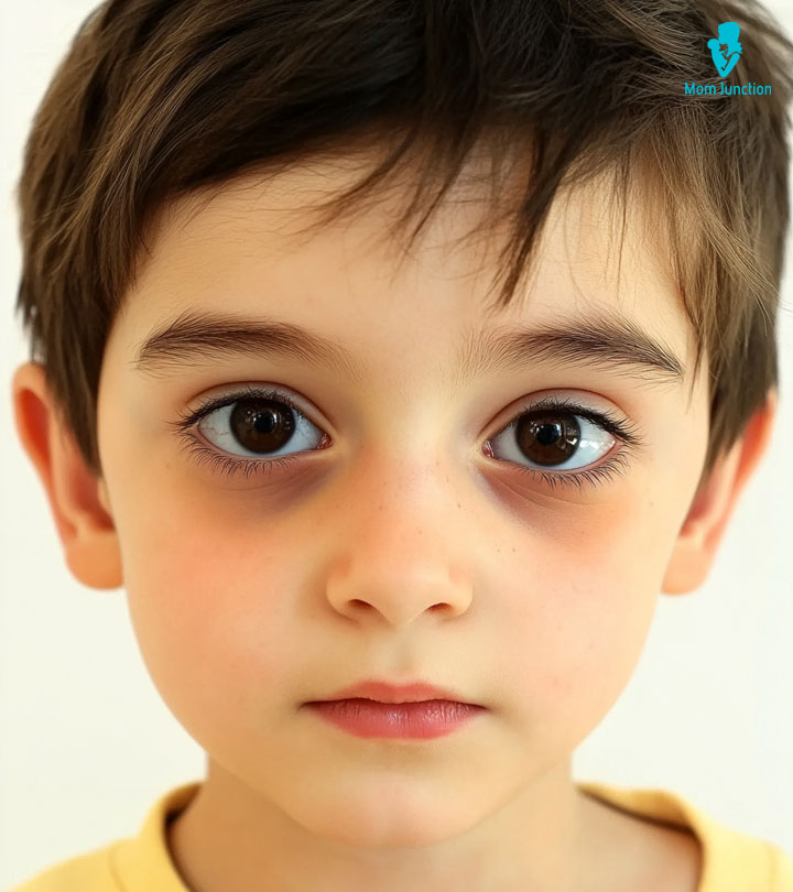 White Spots On A Child's Face: Causes And Treatment