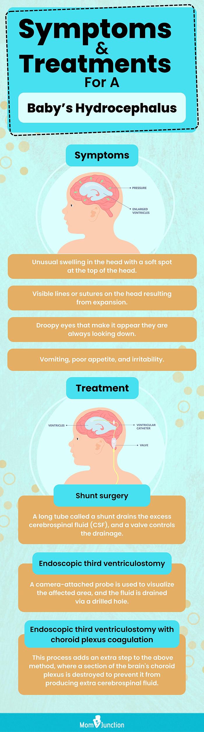 Hydrocephalus In Babies – Causes, Symptoms & Treatment