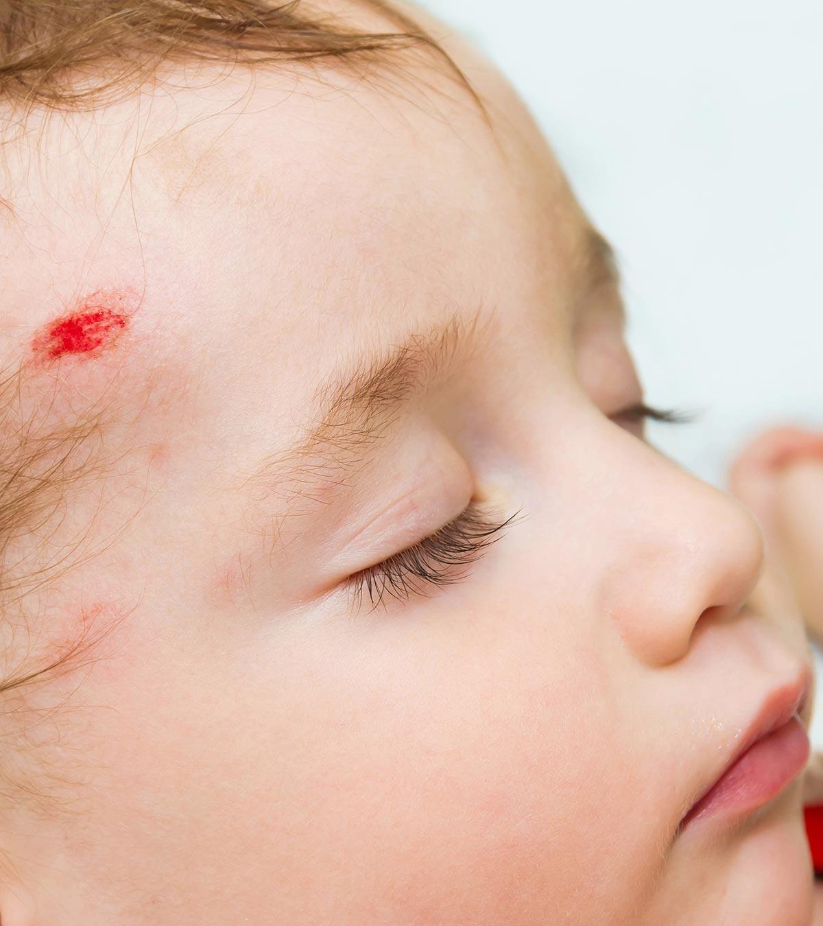 How To Test For Concussion Pupils How To Test For Concussion Pupils