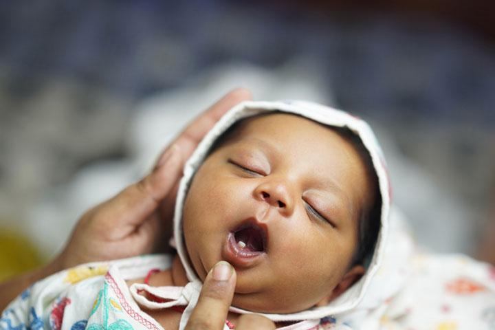 Is It Normal For A Baby To Be Born With Natal Teeth?