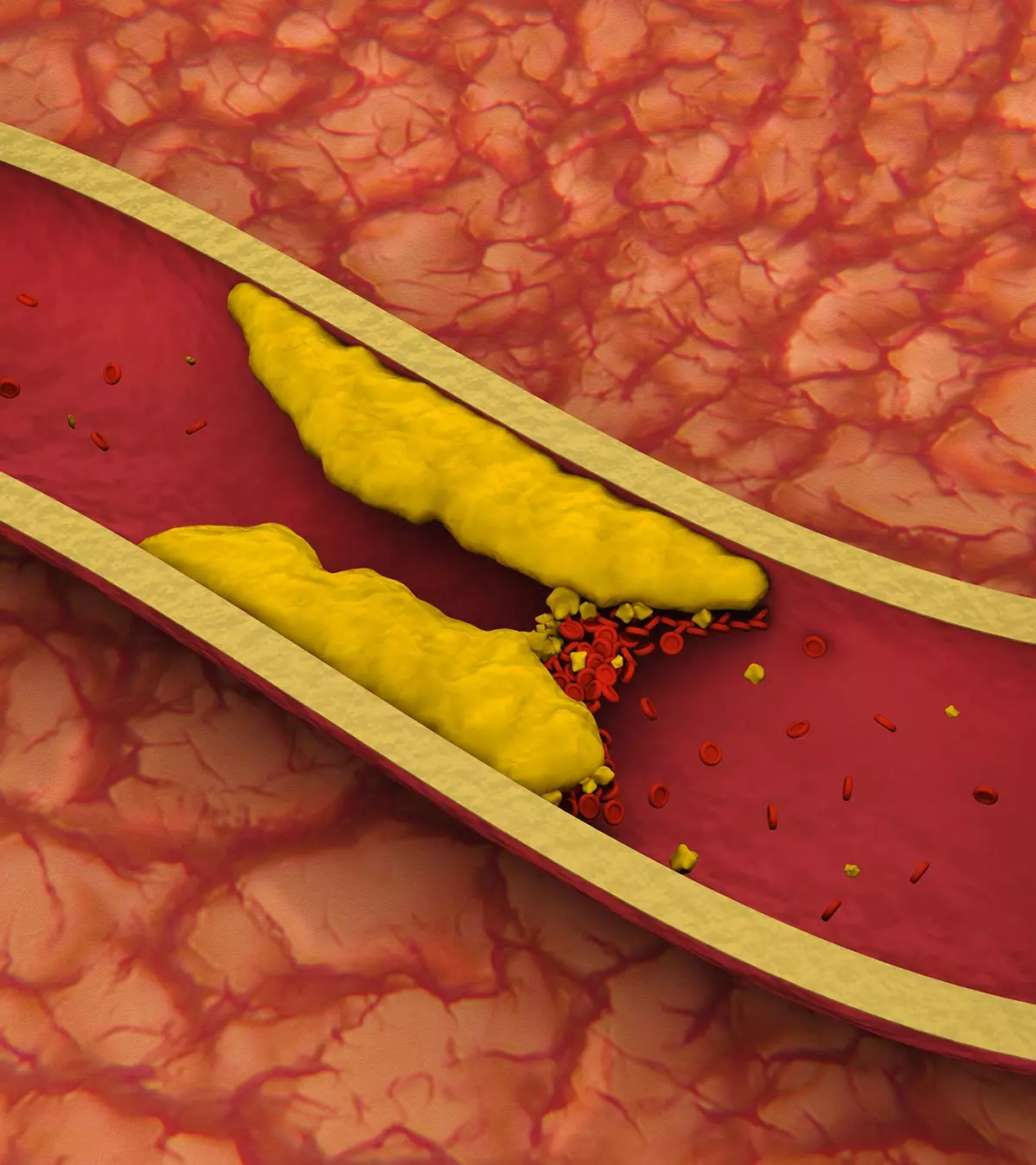 Blood Clots After Childbirth: Comprehensive Guide For New Moms