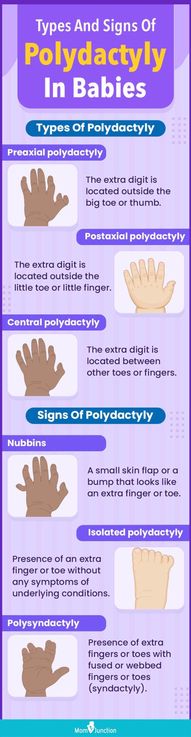 Newborn Polydactyly