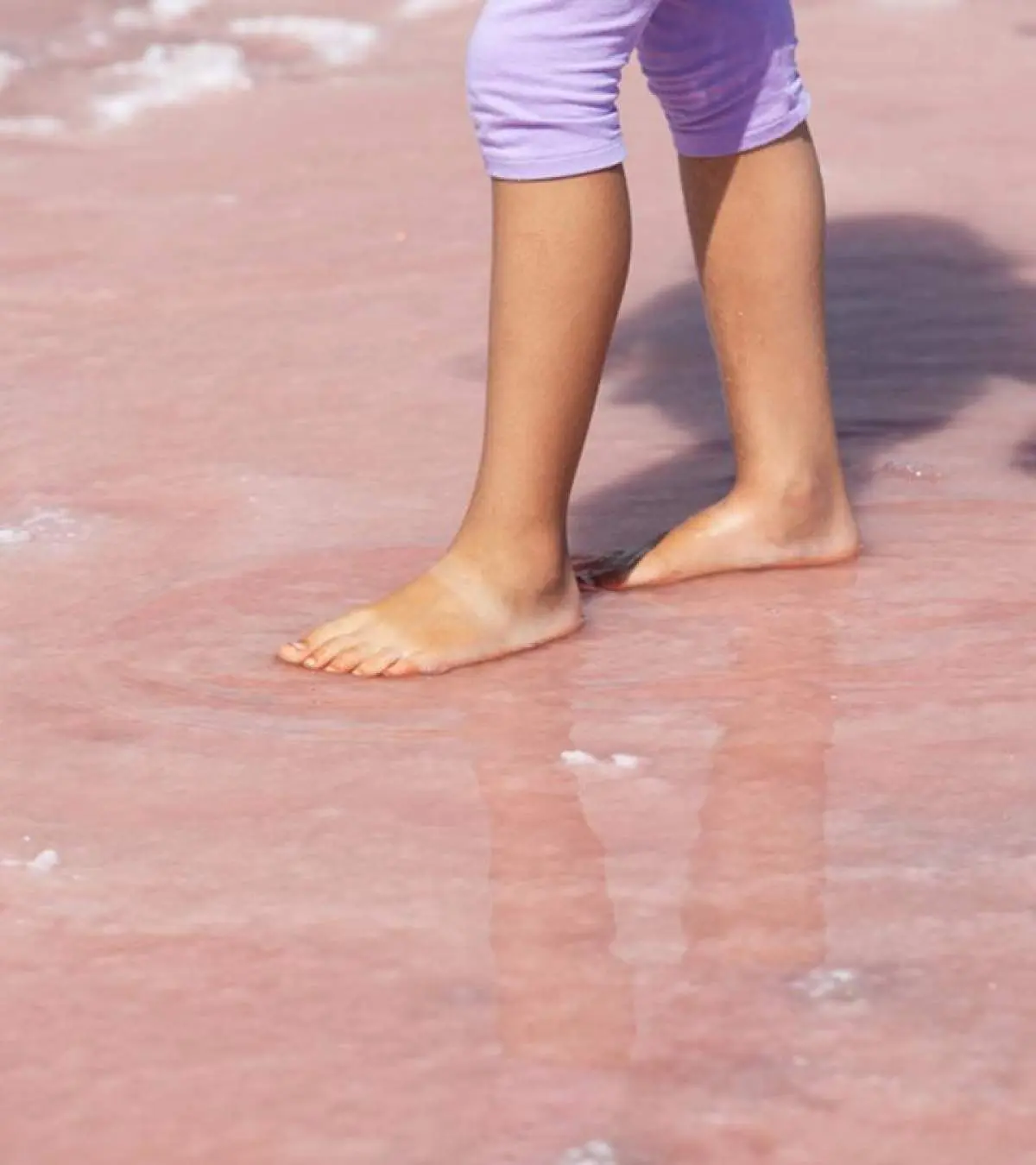 Flat Feet In Children: 5 Causes And Care Tips