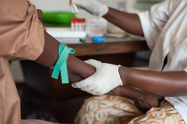 HIV In Babies: Causes, Symptoms, Diagnosis And Treatment