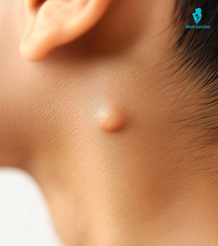 Swollen Lymph Nodes In Children: Causes And When To Worry