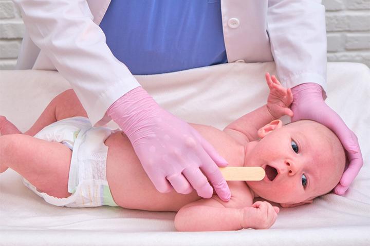 Gingival Epithelial Pearls