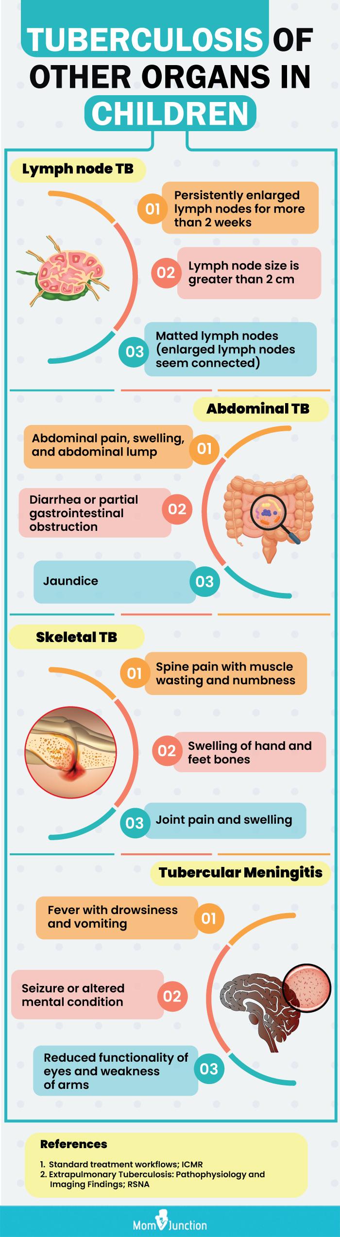 Child With Tuberculosis