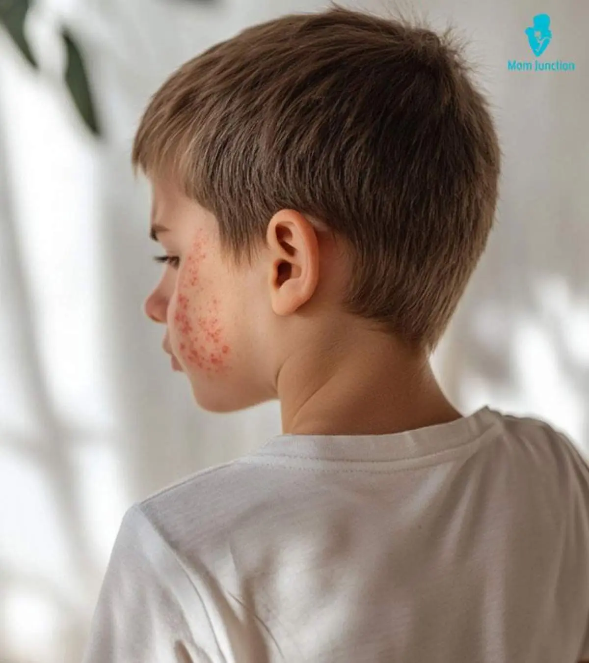 Fifth Disease Erythema Infectiosum (Fifth Disease): Symptoms And