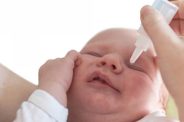10 Causes Of Baby Red Around Eyes, Home Remedies & Treatment