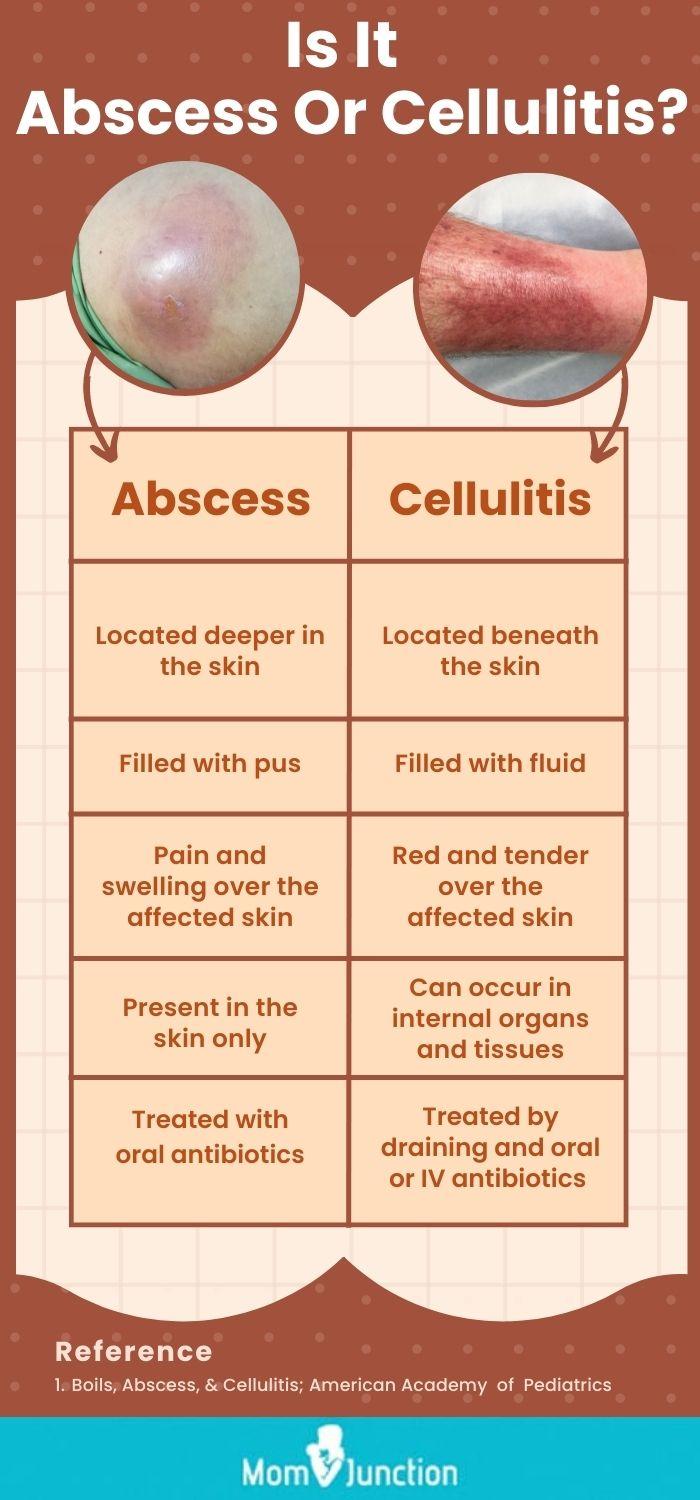 Skin Abscess