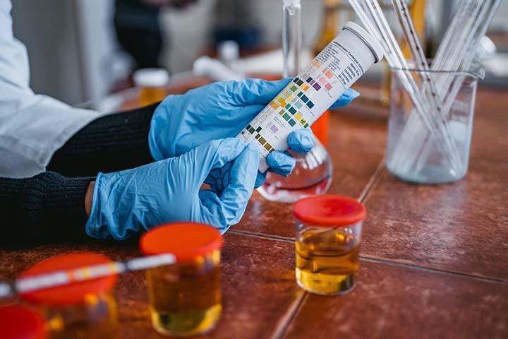 UTI During Pregnancy: Causes, Symptoms, Risks And Treatment