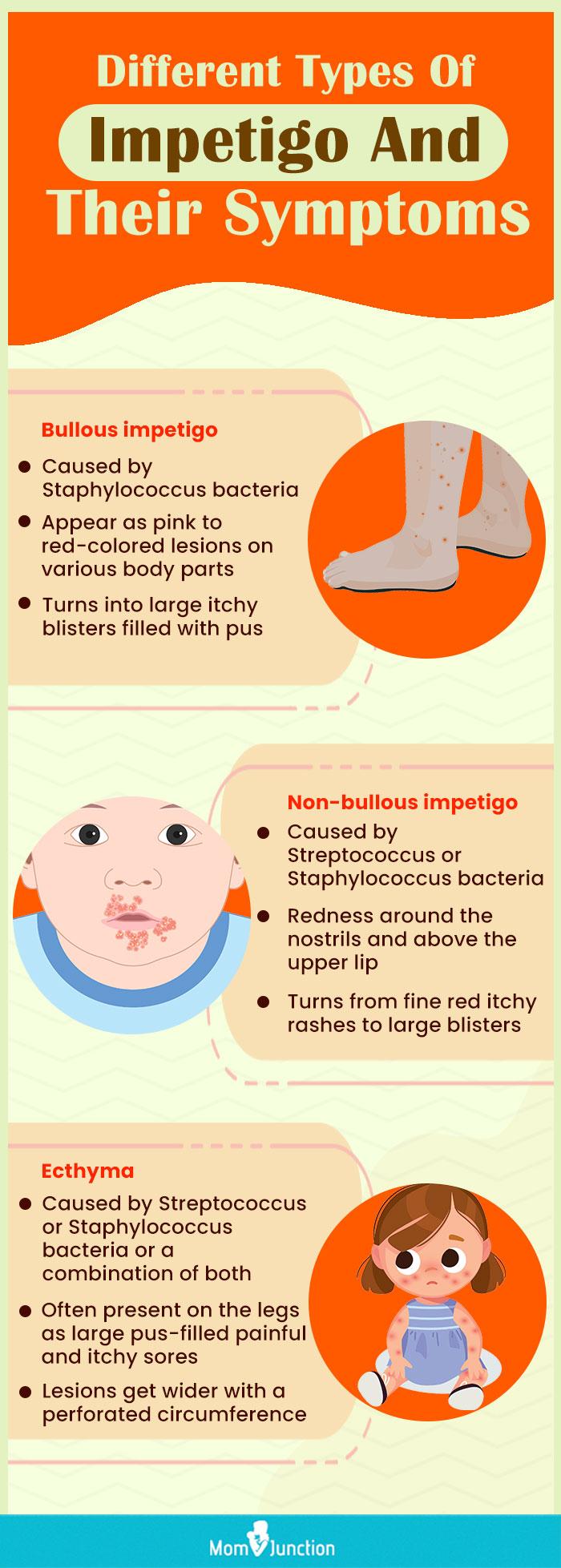 Impetigo Nhs Impetigo Nhs