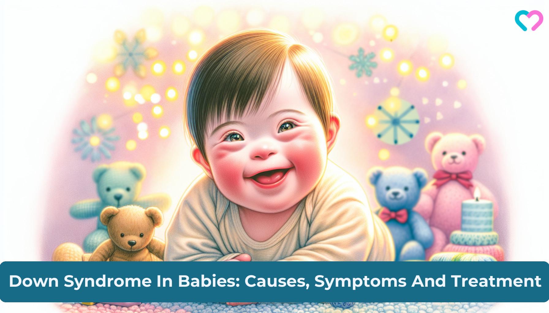 Down Syndrome Symptoms