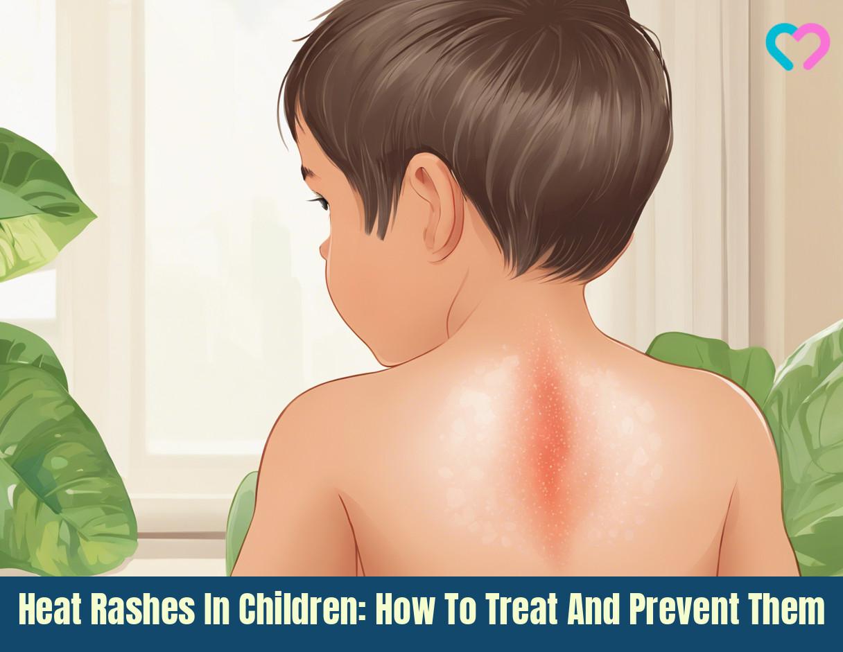 Heat Rashes In Children: How To Treat And Prevent Them | MomJunction